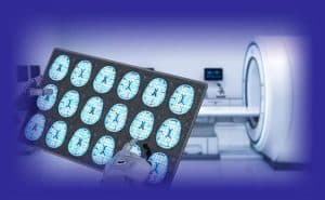 CT Scan Image Dataset | Chest & Brain CT Datasets for AI/ML